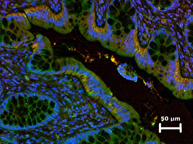 Wenn der Darm nicht zur Ruhe kommt - Familienstudie zu chronisch ...
